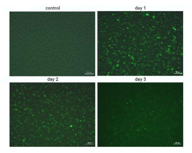如何做 RNA 干扰实验？(常见问题+解决方案）| （MCE) - 知乎