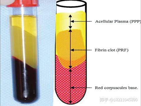 PPP，PRP、PRF都是什么，有什么区别？ - 知乎