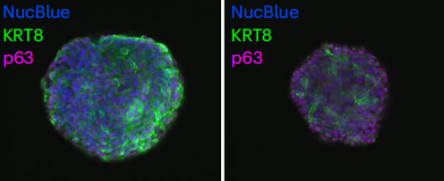 Nat Cell Bio | 谱系特异性代谢控制前列腺管腔分化和抗雄激素治疗反应 - 知乎