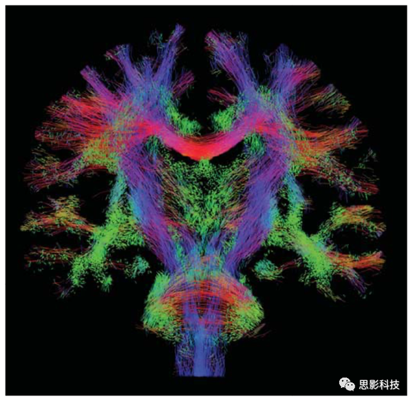 思影科技弥散加权成像（DWI/dMRI）数据处理 - 知乎