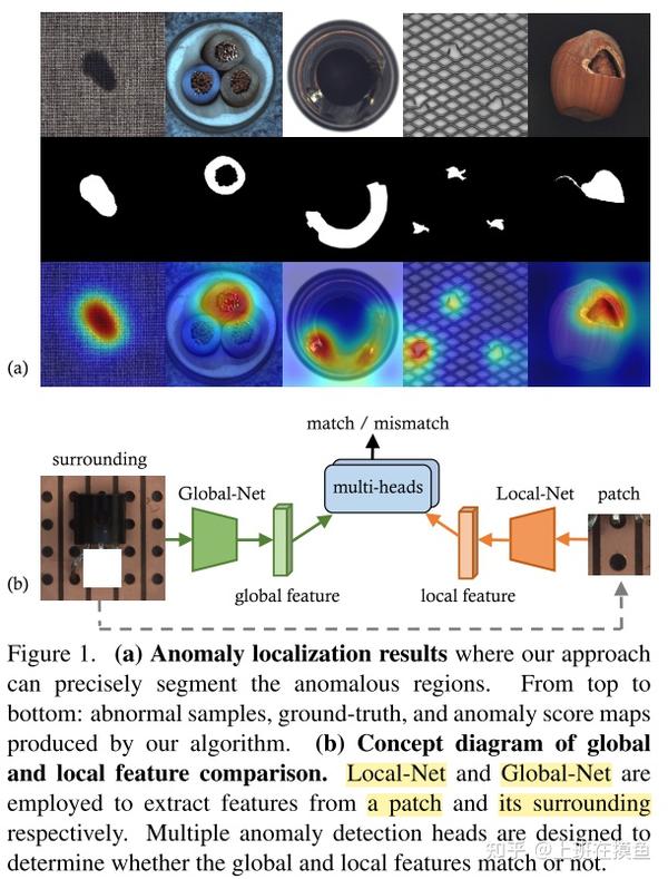 Glancing at the Patch: Anomaly Localization with Global and Local ...