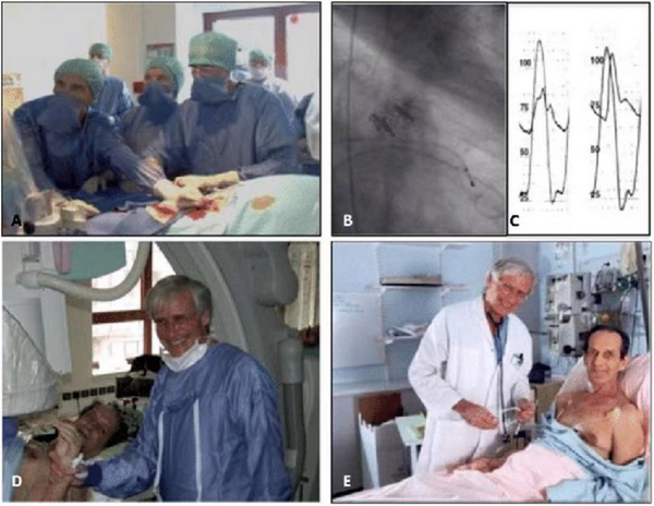 世界首例TAVR术者Alain Cribier教授逝世 - 知乎