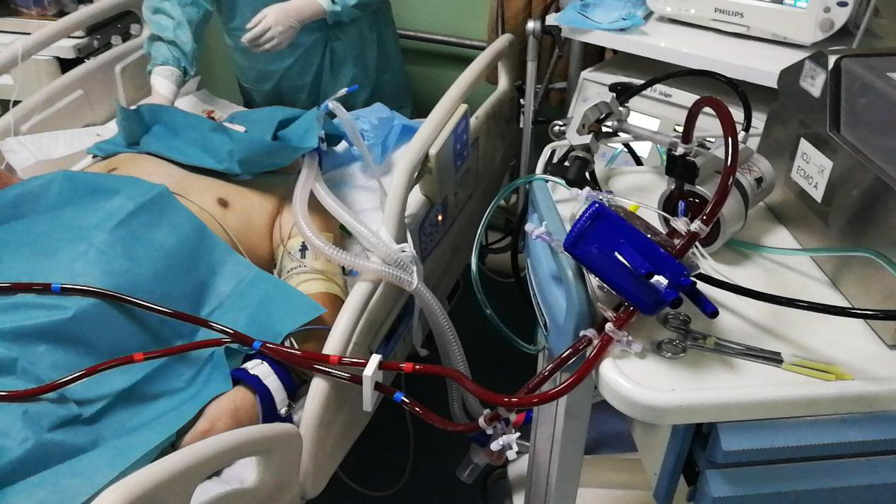 被称为“用钱向上帝买时间”的ECMO，保险能分担它的天价费用吗？ - 知乎