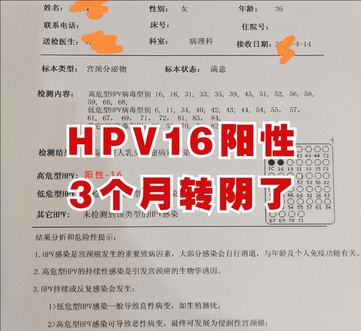 HPV16阳性，3个月转阴了！ - 知乎