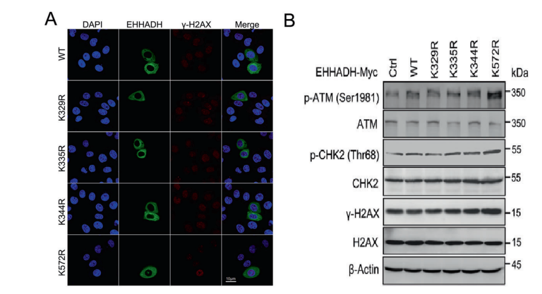 Cell Death Dis | 复旦大学周翔宇组报道ACOX2调控巴豆酰化修饰介导肝脏代谢稳态 - 知乎