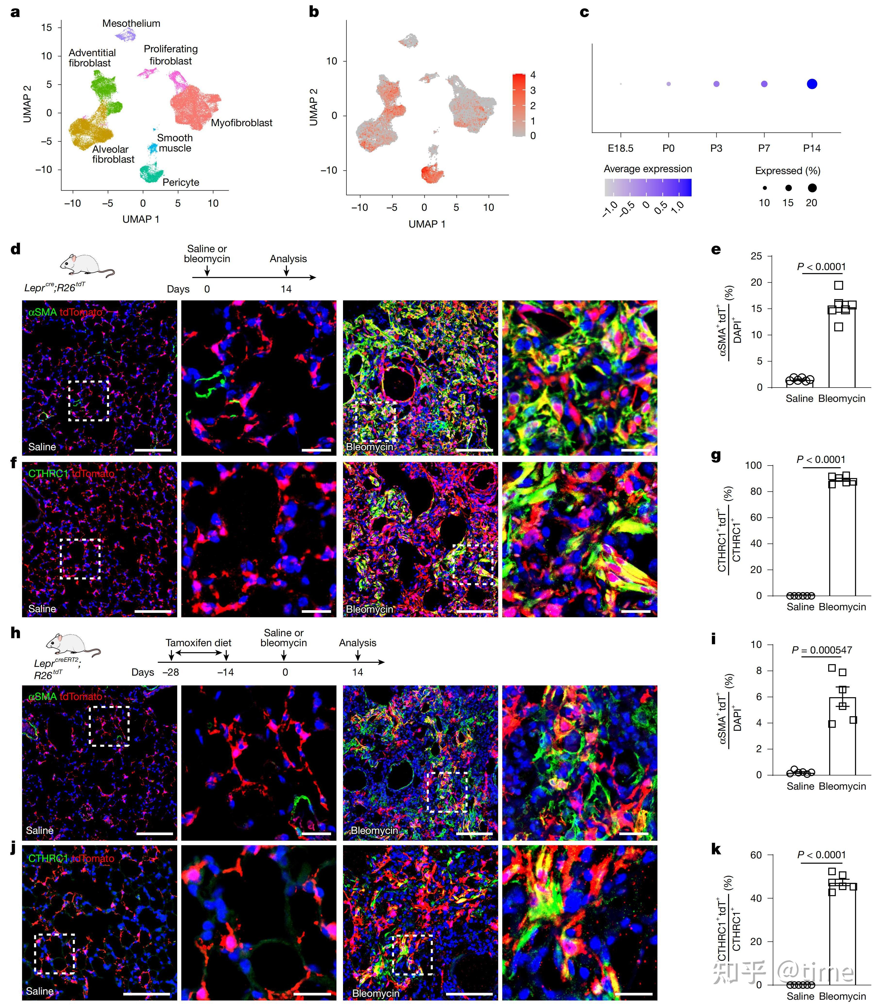 文献分享 | Nature：RUNX2通过肺泡-to-病理性成纤维细胞转化促进纤维化 - 知乎