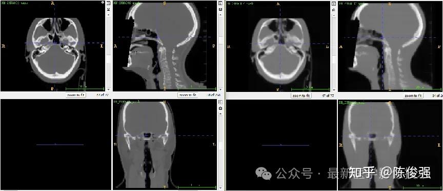 SynthRAD2025——用于放射治疗的计算机断层扫描生成挑战赛 - 知乎