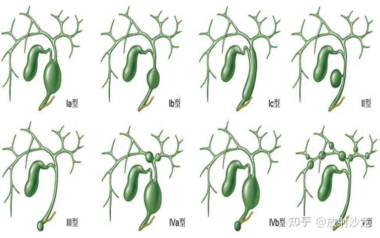 是什么病让腹部出现一棵「树」？这个影像学征象必须记住！ - 知乎
