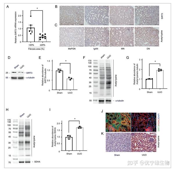 线粒体乙酰化和代谢疾病之间也有关系？一篇高分文献带你了解研究思路 - 知乎