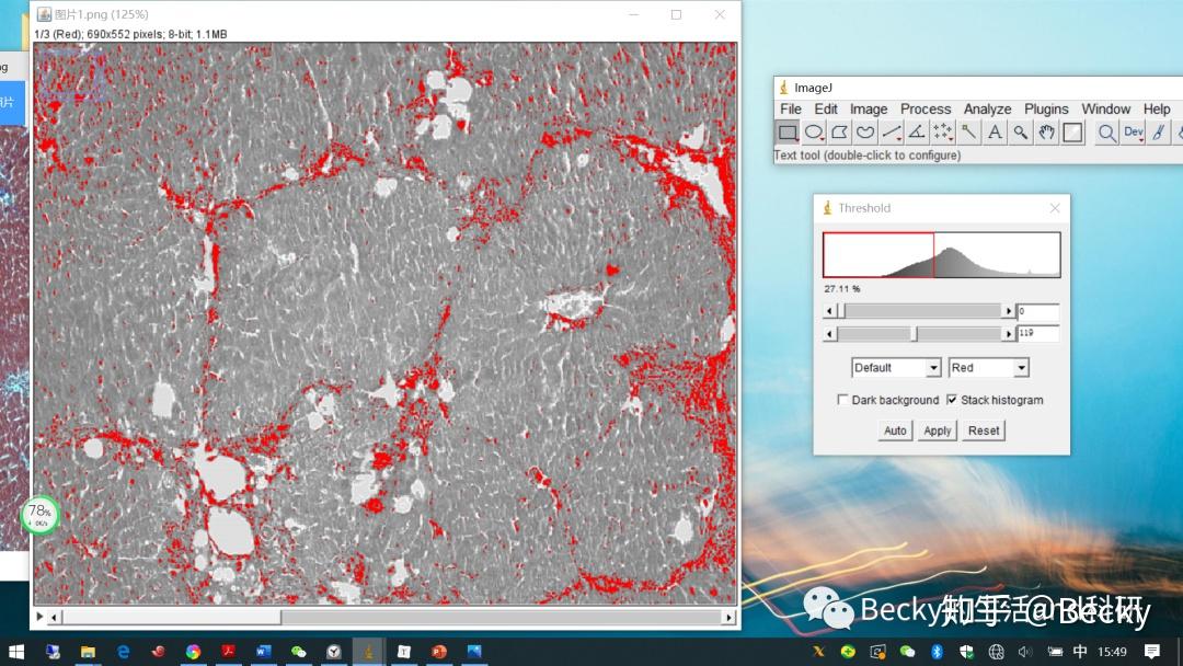 计算马松染色中胶原纤维面积-imageJ - 知乎