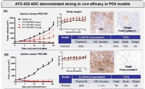 进展期胃癌靶向治疗之新星-Claudin 18.2 - 知乎