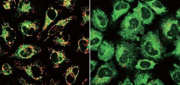 干货｜细胞铁死亡（Ferroptosis）——细胞死亡的新模式 - 知乎