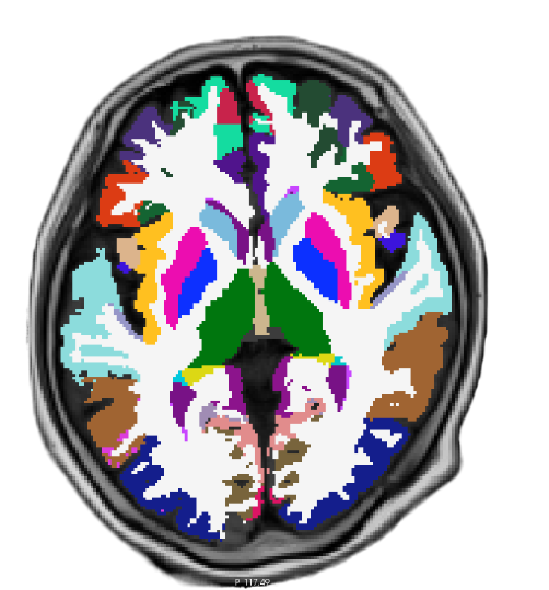 全脑分割方法Fastsurfer复现 - 知乎