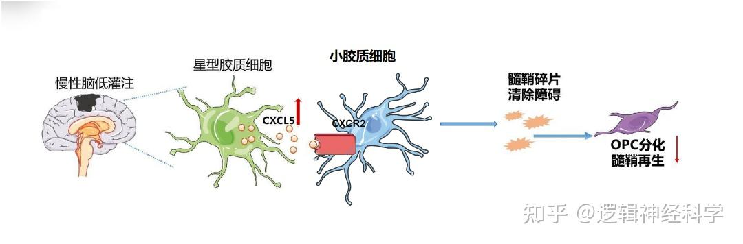 J Neuroinflammation︱南京大学医学院附属鼓楼医院徐运/邱树卫团队揭示星形胶质细胞源性CXCL5在慢性缺血性脑白质损伤中的作用 ...