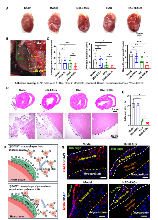 《Sci. Adv.》：可注射光固化Janus水凝胶递送外泌体用于减少心脏手术后粘连 - 知乎
