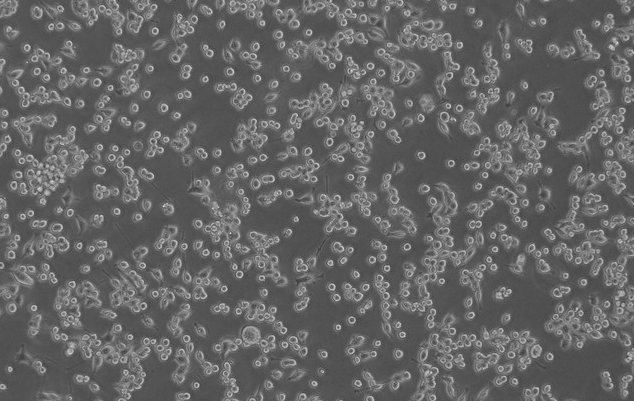 【心得】BV2细胞培养心得 - 知乎