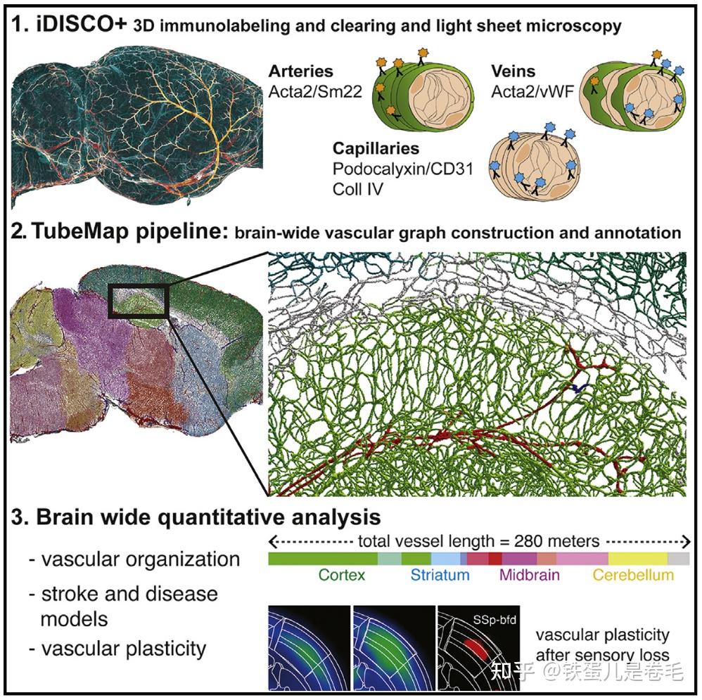 Vessel Segmentation 文章阅读（1） - 知乎
