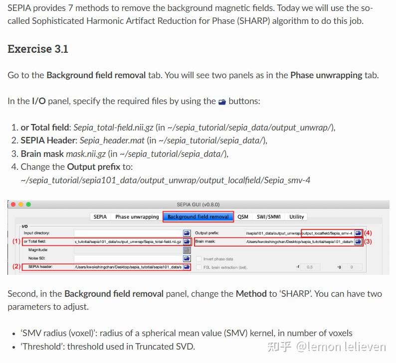 磁化率定量分析（QSM） - 知乎