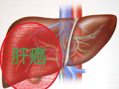 2024 ASCO | 阿斯利康突破性CAR-T疗法C-CAR031治疗GPC3阳性肝癌，超90%患者肿瘤缩小！ - 知乎