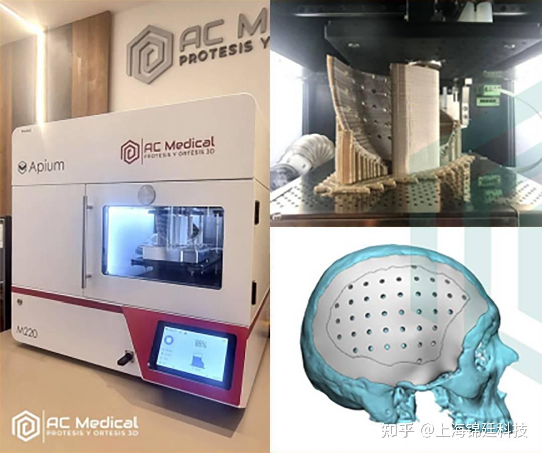 聚焦精准医疗: Apium M220的医疗案例分享 - 知乎