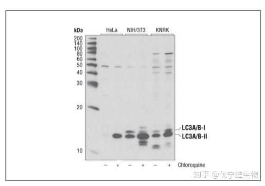 【小优细节君】细胞自噬标志物LC3检测要点，必看！ - 知乎