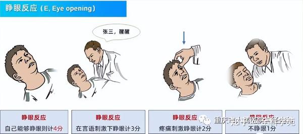 格拉斯哥（GCS）昏迷评分 - 知乎