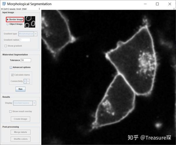 ImageJ实用教程——细胞膜荧光强度检测(定量分析篇) - 知乎