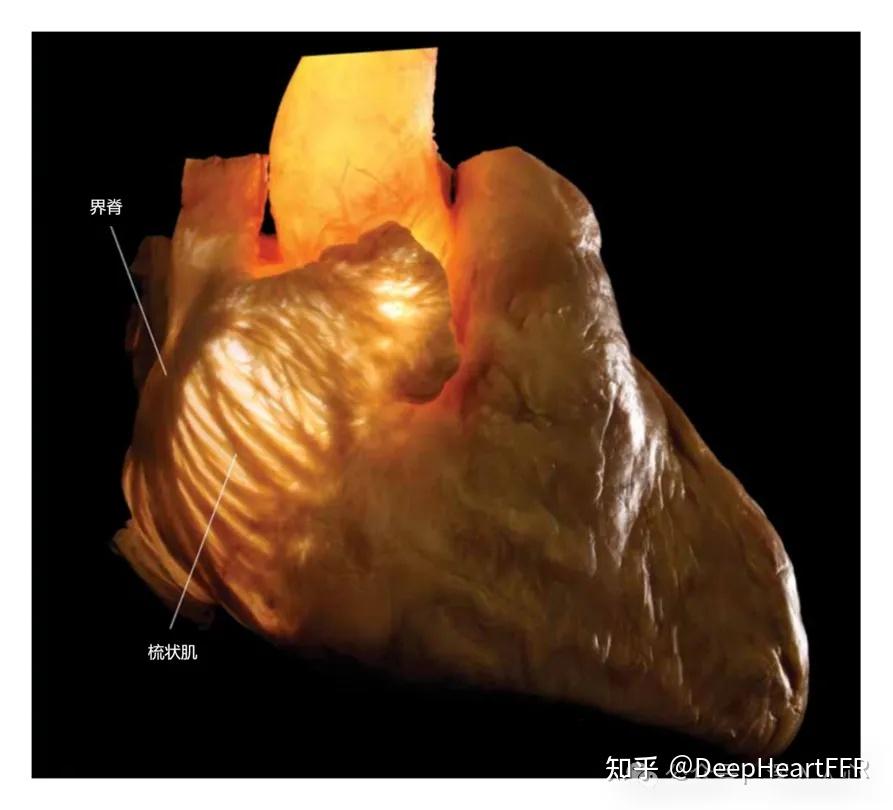 视觉效果最震撼的心脏解剖图（Atlas of cardiac anatomy）：（二）心脏的右前斜位视图 - 知乎