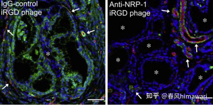 iRGD是否与如何帮助药物进入肿瘤？ - 知乎