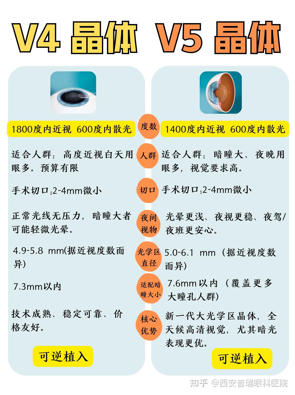 西安普瑞眼科医院专家解答：ICL晶体植入术，选V4c还是新出的V5？ - 知乎