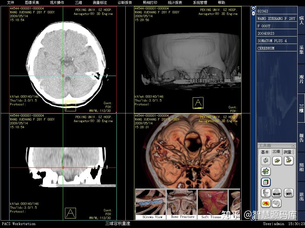 医学影像信息系统（PACS/RIS）： 构建数字化影像诊疗的核心平台 - 知乎