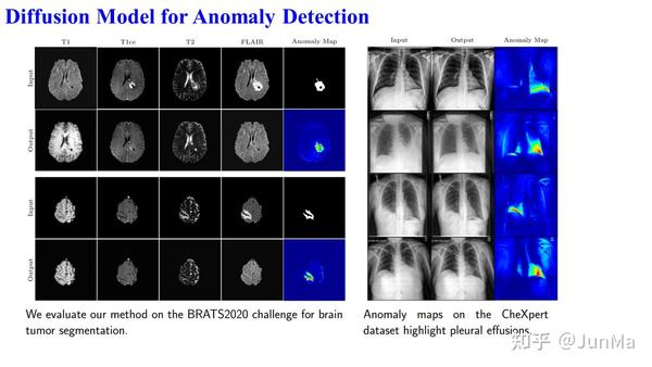 Diffusion Models in MICCAI 2022 - 知乎