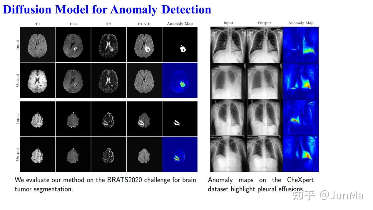 Diffusion Models in MICCAI 2022 - 知乎