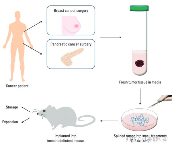 最全PDX模型构建方法整理，还不快收藏！ - 知乎