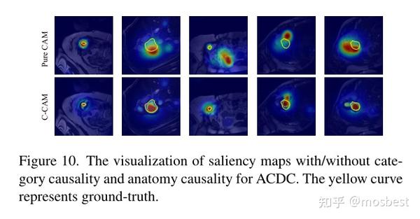 CVPR: C-CAM: Causal CAM for Weakly Supervised Semantic Segmentation on Medical Image - 知乎