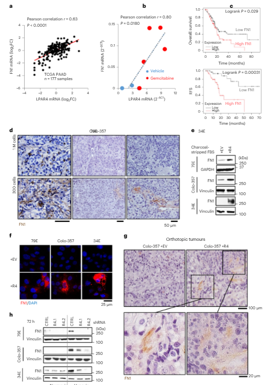 Nat Cell Bio | 胰腺肿瘤细胞创造促瘤微环境克服局部“隔离应激” - 知乎