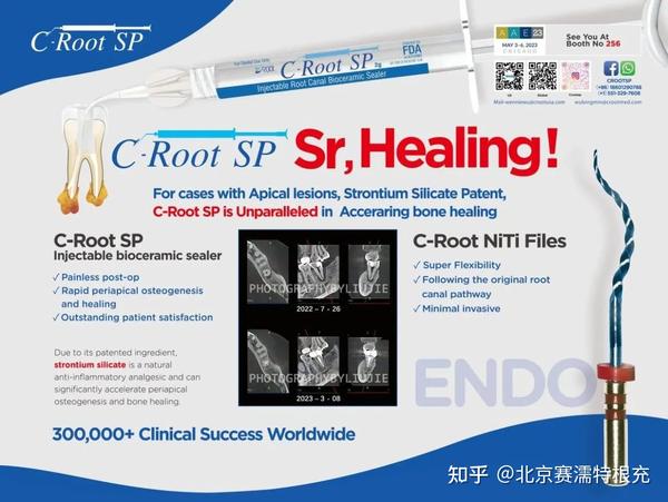 直击AAE展 | 当赛濡特C-Root SP与国外牙科医生见面时！ - 知乎