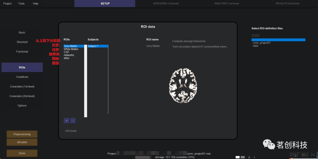 手把手教你使用CONN（预处理） - 知乎