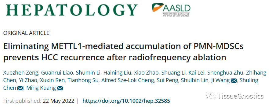 Hepatology|中山大学附属第一医院匡铭教授团队揭示肝细胞癌射频消融后复发潜在机制 - 知乎