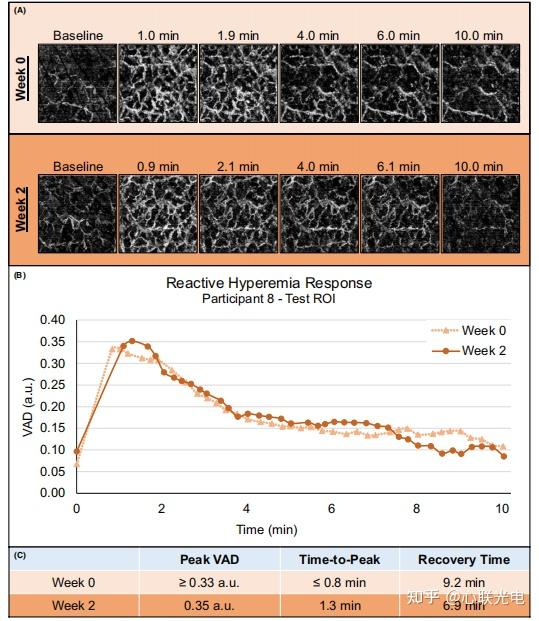 Skin Res Technol：使用OCTA研究皮肤对机械应力的适应性 - 知乎