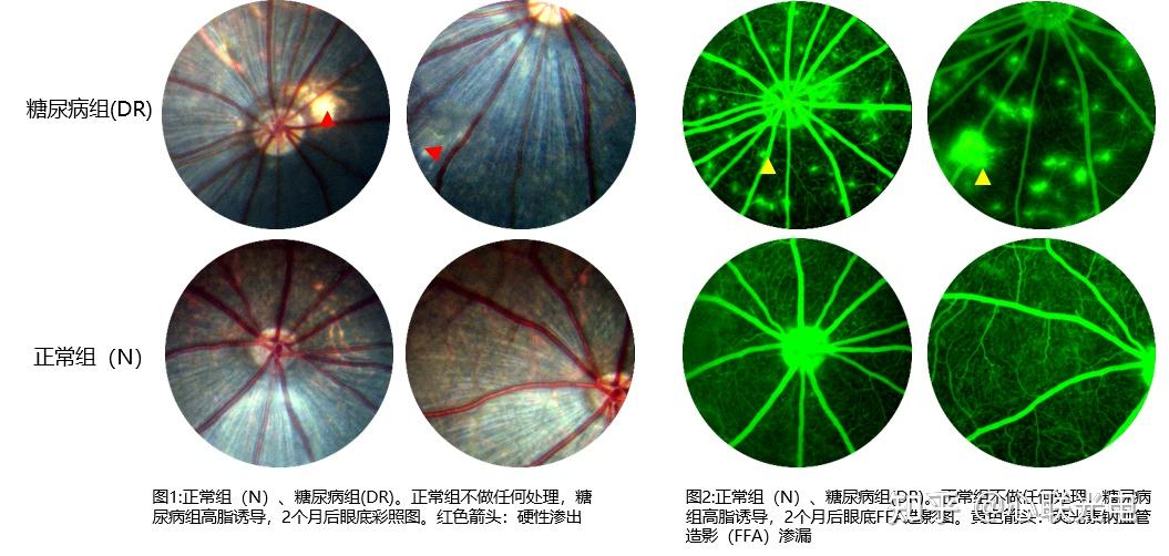 小动物视网膜成像系统 - 知乎