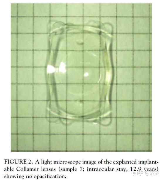 ICL长期安全性文献解读之ICL植入后晶体性状和透光特性长期稳定 - 知乎