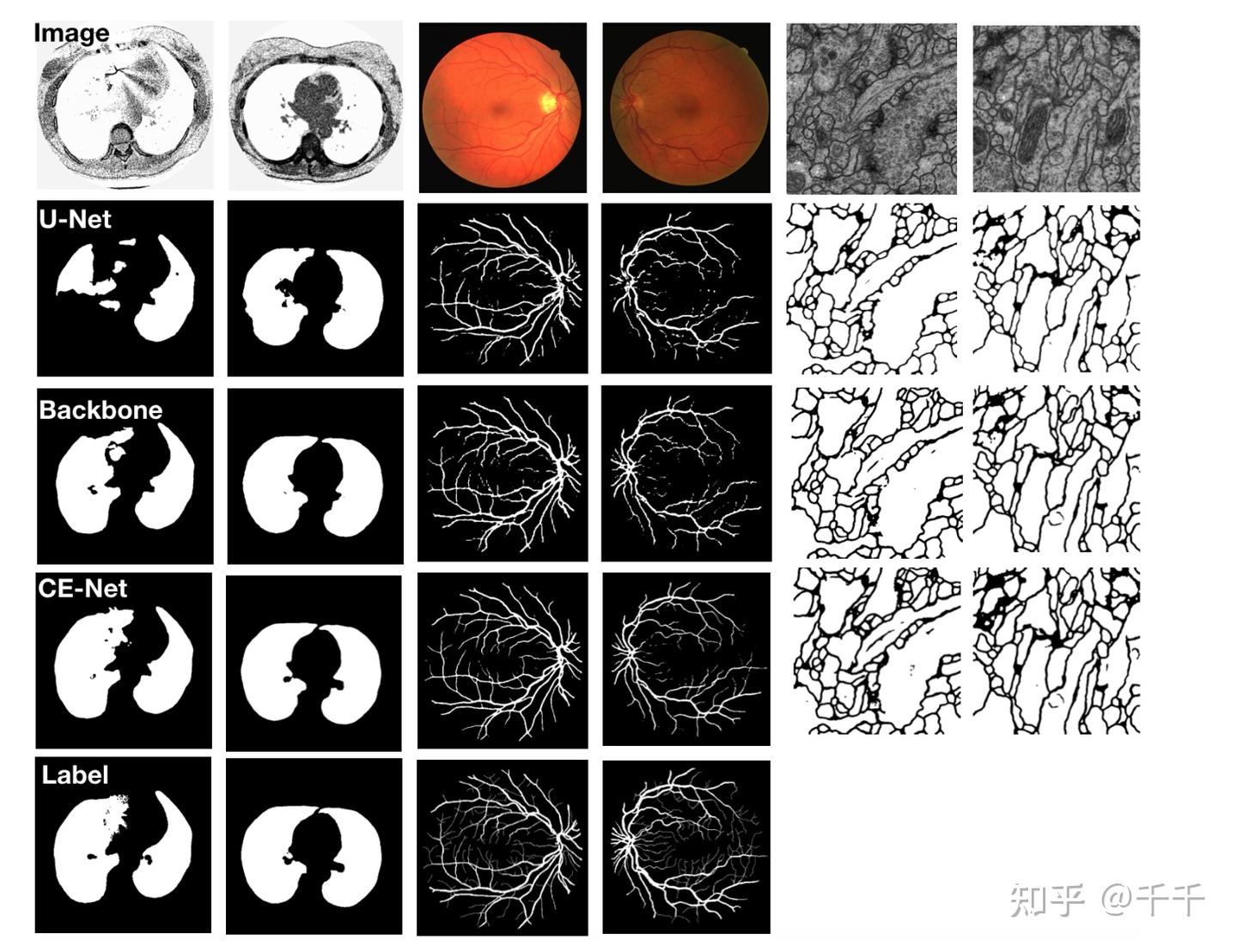 CE-Net: Context Encoder Network for 2D Medical Image Segmentation（译文） CE-Net：用于2D医学图像分割的上下文编码器网络 ...