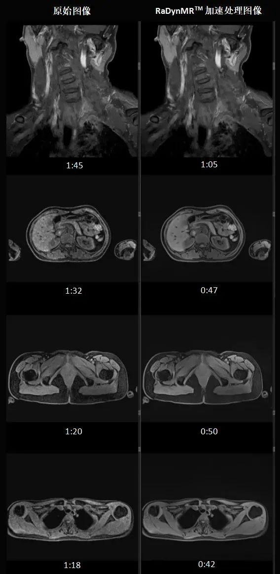 临床案例——RaDynMR、RaDynPET、RaDynCT、RaDynSPECT - 知乎