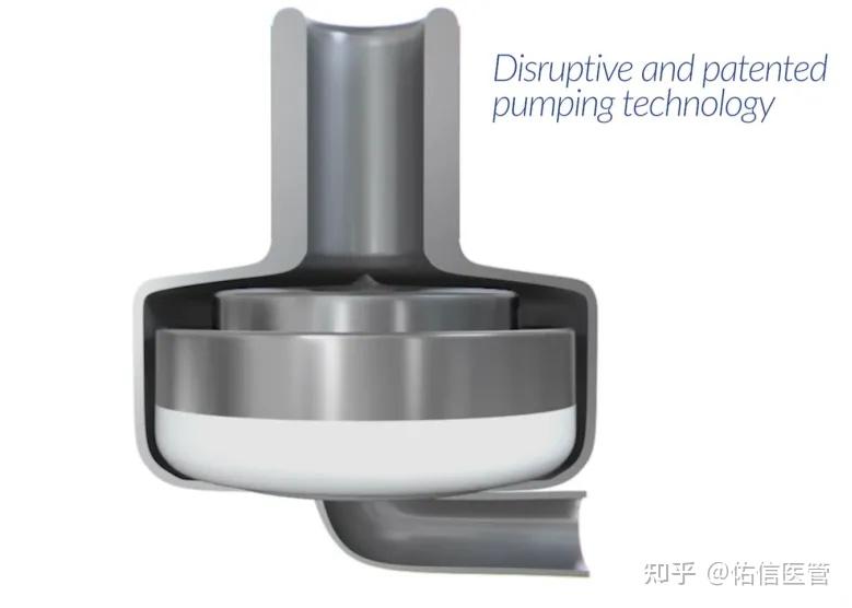 全球首植！基于独特波浪膜技术的左心室辅助装置 - 知乎