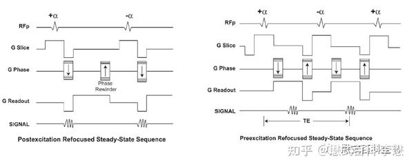 重聚回波SSFP序列 - 知乎