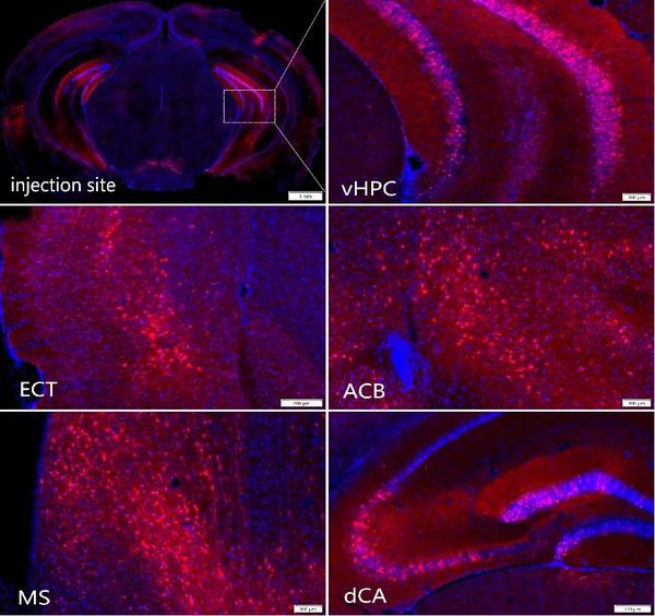 小布tips | 外周PRV示踪-快，准，亮！你想要的都在这！ - 知乎