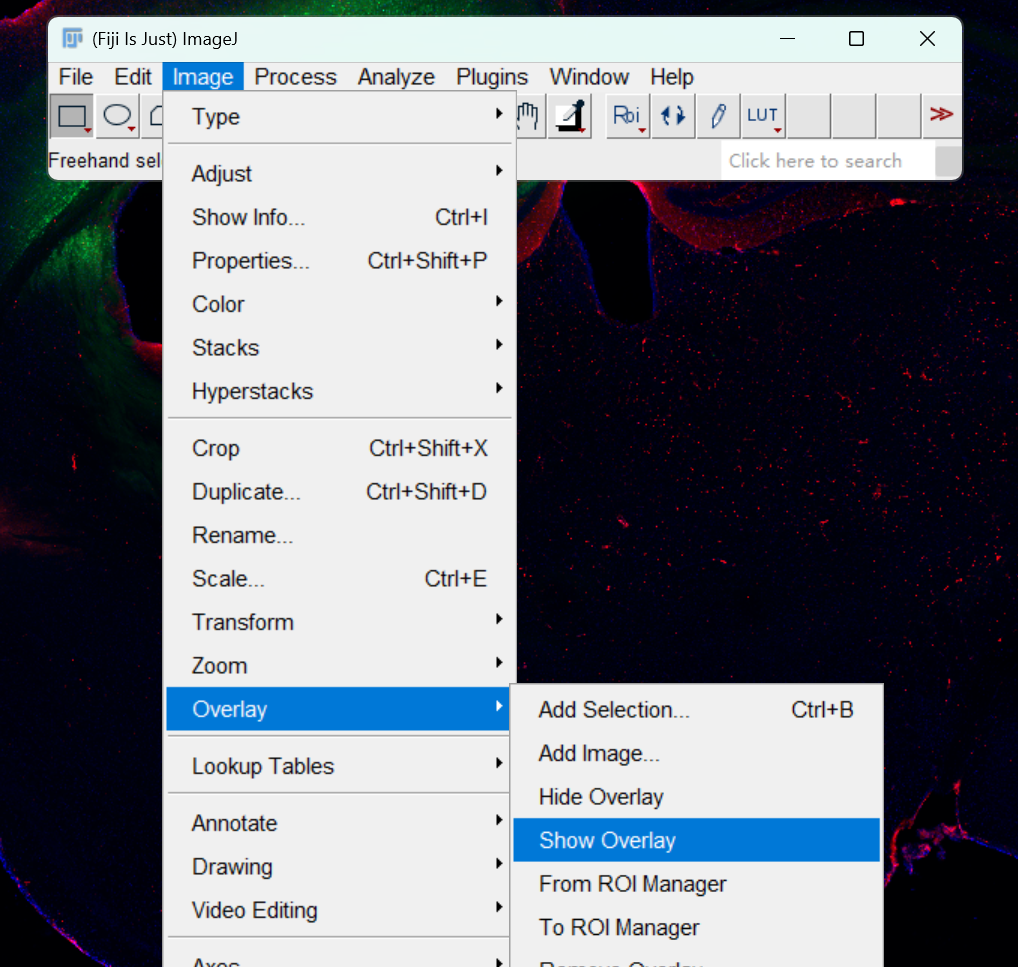 ImageJ Overlay：如何隐藏、显示和导出 - 知乎
