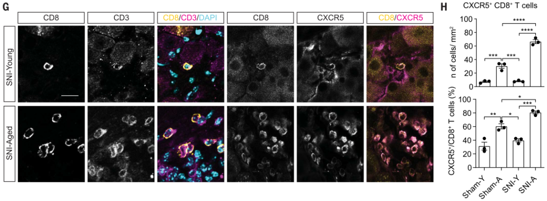 Science：为什么老年人神经损伤后难以恢复？可逆的CD8+ T细胞与神经元交流导致衰老依赖的神经再生衰退 - 知乎