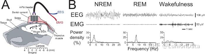 【脑科学】基于EEG的小动物睡眠研究 - 知乎